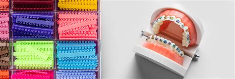 Braces Rubber Bands Uses Types And How Braces Elastics Work