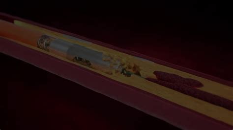 Alexis Pinaton On Linkedin Learn More About Bds Rotarex™ Rotational