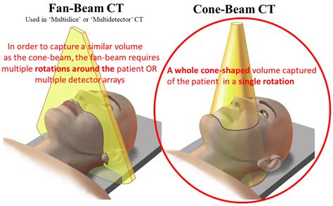 An Overview Of Cone Beam Computed Tomography And Dental Panoramic