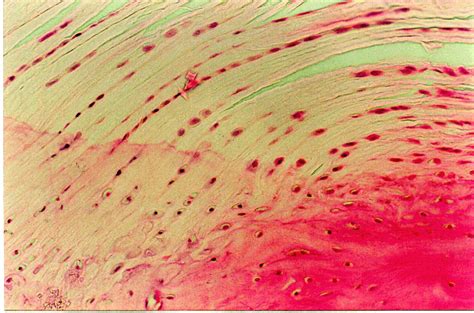 Fibrocartilage Connective Tissue Cartilage