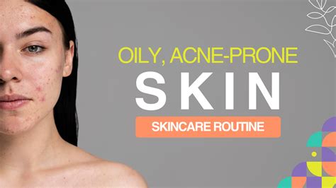 Best Skin Products For Acne Prone Oily Skin Detroit Chinatown