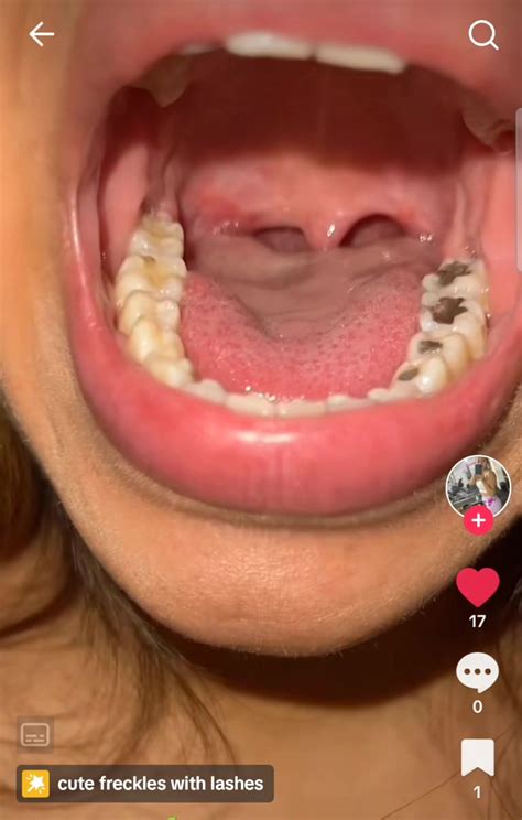Latin Woman Shows Her Uvula And Tonsils Türkçe