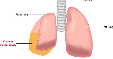 Medical Documentation Proofreading Example 6