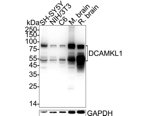 Dcamkl1 Recombinant Rabbit Monoclonal Antibody [ja11 03] Et1704 10 Huabio