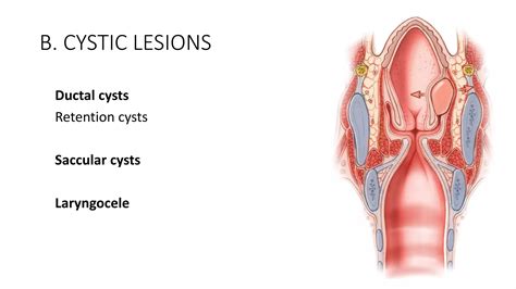 Benign Lesions Of Larynx Pptx