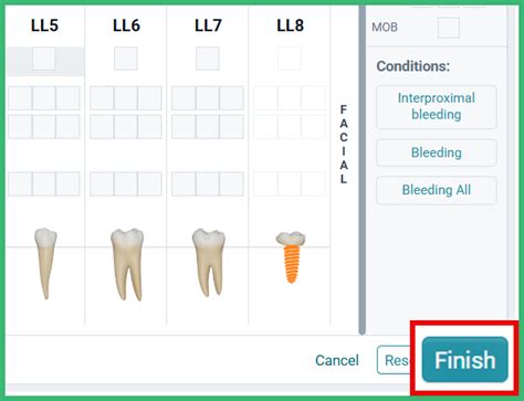 Create A Perio Chart Carestack