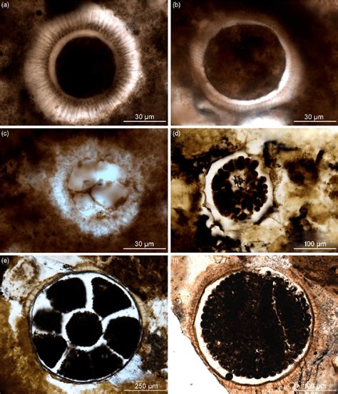Organic Walled Microfossils Containing Internal Body And Multiple Cells Download Scientific