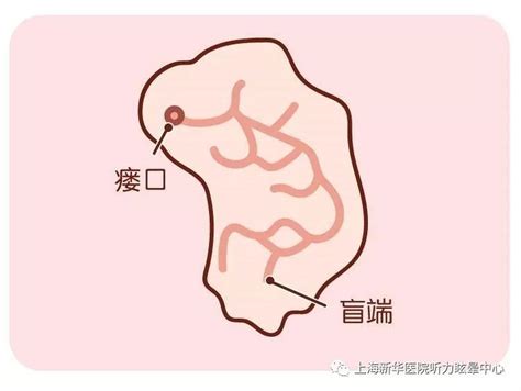 先天性耳前瘘管 小小的窦道，大大的烦恼