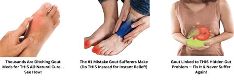 Gout Vs Cellulitis Key Differences Explained