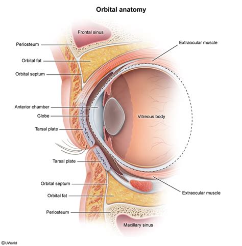 Preseptal Cellulitis Infectious Diseases Uworld Medical Library
