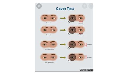 Cover Testpptx Eye And Vision Conditions Diseases And Conditions