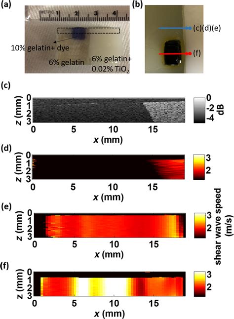 Oct Swei A Cross Section View B Top View Of Designed Imaging