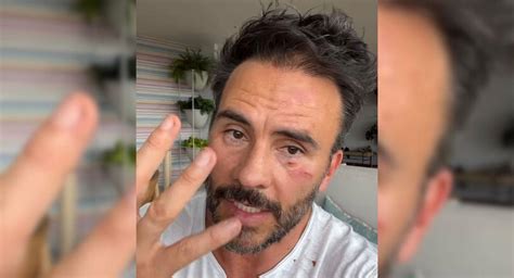 Mientras Paseaba Con Sus Hijos El Actor Juan Pablo Raba Fue Asaltado