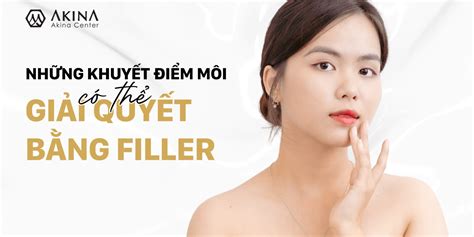Những Khuyết Điểm Mỗi Có Thể Giải Quyết Bằng Filler Akina Center
