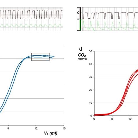 Representative Traces A Time Based Capnogram And The Corresponding