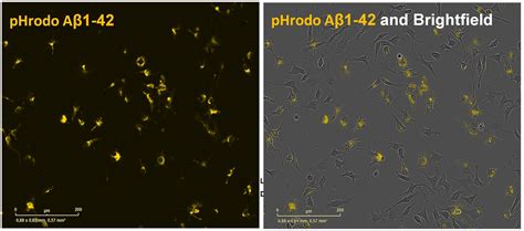 Phagocytosis Scantox Contract Research Organization