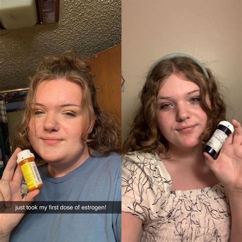 Estrogen Pills Before And After
