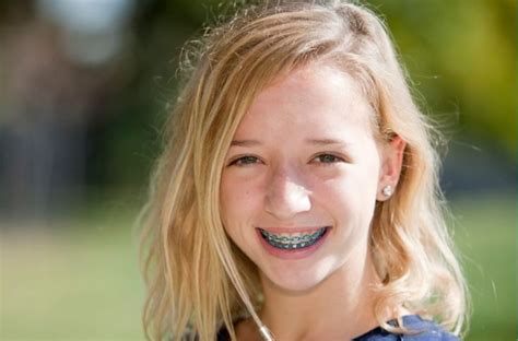 Pin On Girls With Braces