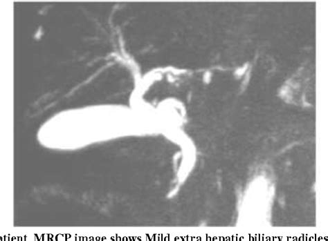 What Is Ercp And Mrcp At Charles Boucher Blog