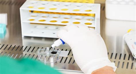 Sperm Dna Fragmentation Test Improve Ivf Success Rate