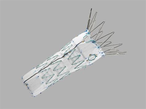 Zenith® Fenestrated Aaa Endovascular Graft Proximal Body Grafts Cook Medical