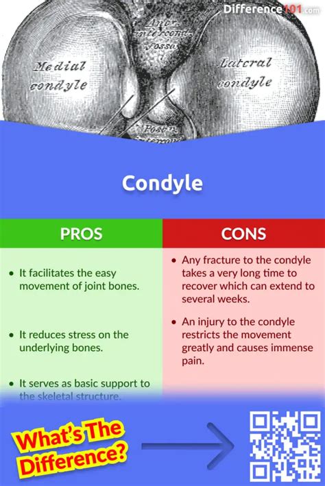 Epicondyle Vs Condyle