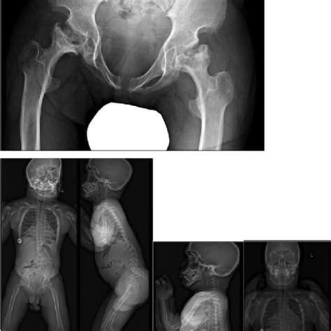 Ap Pelvis And Standing And Sitting Radiographs Download Scientific Diagram