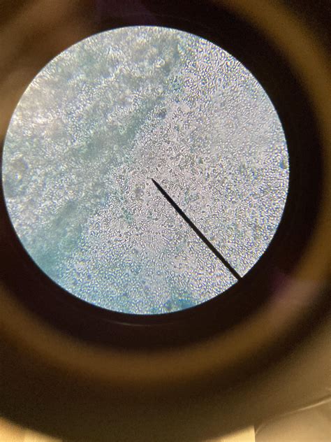 Scoby Bacteria Under A Microscope Stained Thanks To My Biology