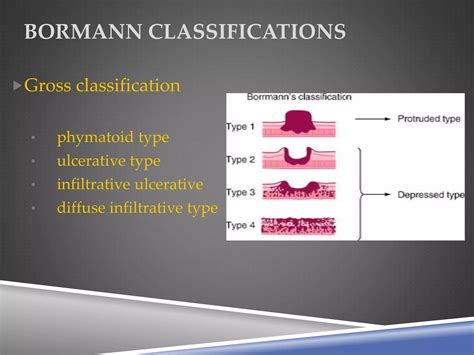 Gastric Cancer Stomach Tumor Pptx