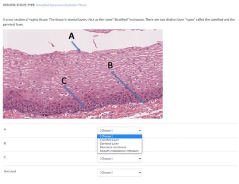 Solved Specific Tissue Type Stratified Squamous Epithelial