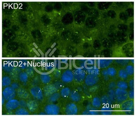 Polycystin 2 Pkd2 Antibody Bicell Scientific®
