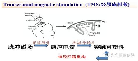一文详解经颅磁刺激（tms）的原理、功能与应用 知乎