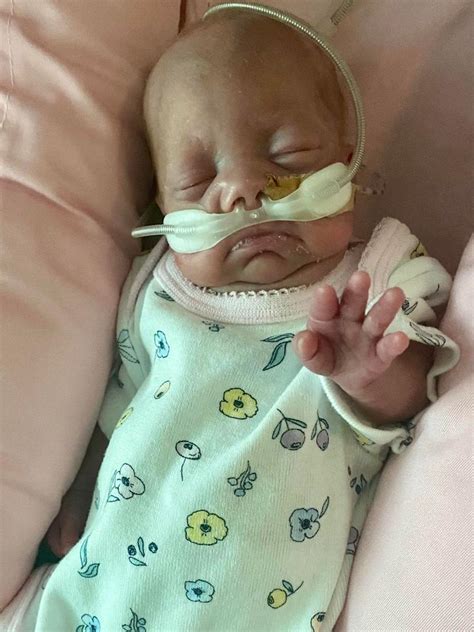 Townsville Hospital Mums 23 Week Birth After Pre Eclampsia Diagnosis