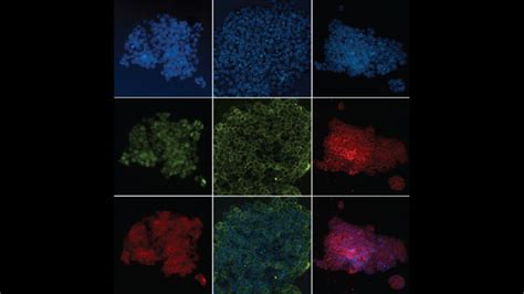 Researchers Use Of Stem Cells Could Open Another Door To Immunotherapy