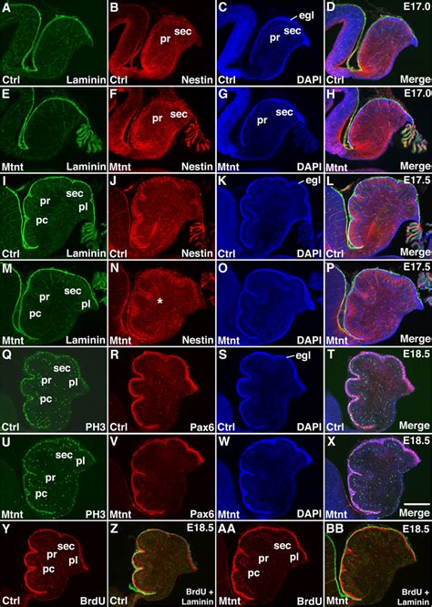 Defective Basement Membrane Retention At The Developing Fissures In The