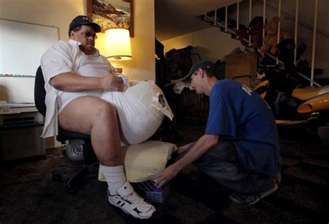 Friend Las Vegas Man With 132 Pound Scrotum Was ‘trapped By His Own