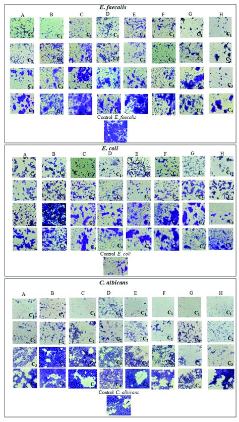 Optical Microscopy For Hydroxyapatite Samples For E Faecalis E Coli