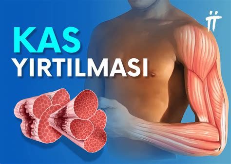 Farenjiti Anlamak Nedenleri Belirtileri Ve Tedavi Seçenekleri Vjcpst