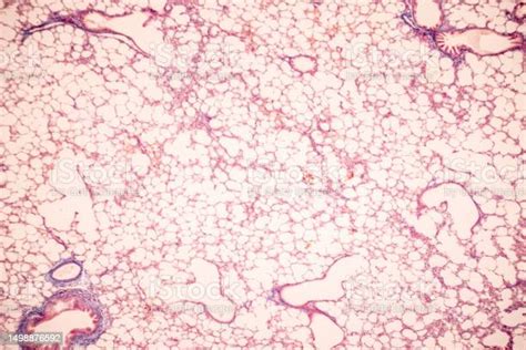 Human Lung Pathology Under Light Microscope The Lungs Is Organs Of The