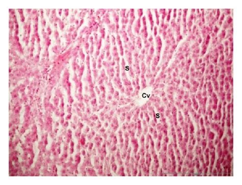 Light Microscope Examination Of Liver Tissues Photomicrograph Of Liver