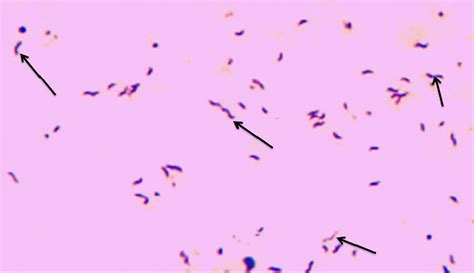 Shows Cells Of Campylobacter Species From Isolate Colony Showing