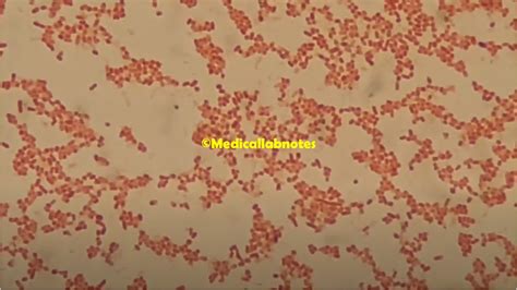Pantoea Introduction Classification Morphology Pathogenicity