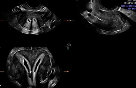 Echographie Gynécologique Le Chesnay Cedef