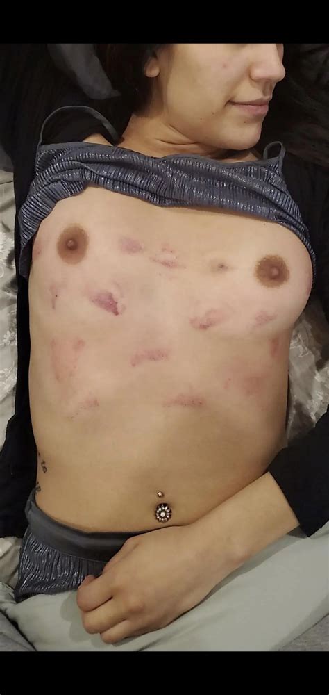 Hickeys Anyone Scrolller