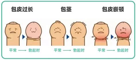 割过包皮的人都知道的事 知乎