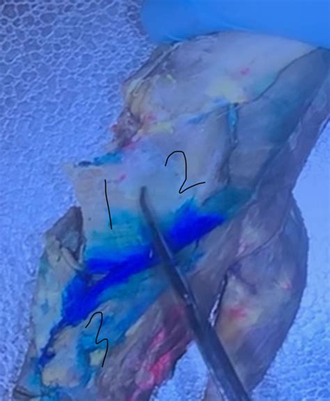 Quiz 5 Review Mink Dissection Lab Pictures 3 3 Diagram Quizlet