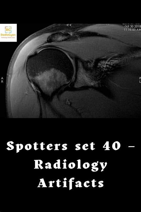Radiology Artifacts What You Need To Know
