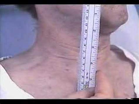 Estimating Jugular Venous Pressure Heywood Youtube