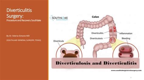 Diverticulitis Surgery Procedure And Recovery Southlakepdf