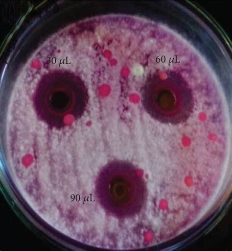 Fungicidal Activity Of The Synthesized Agnps Against The Selected Download Scientific Diagram